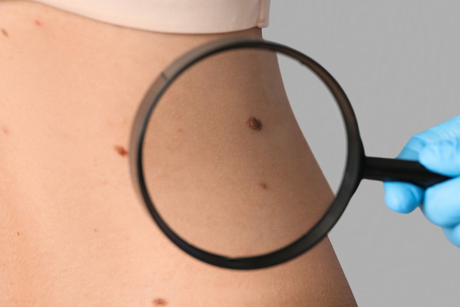 Critical Signs of Skin Cancer You Shouldn't Ignore | Duncan Dermatology